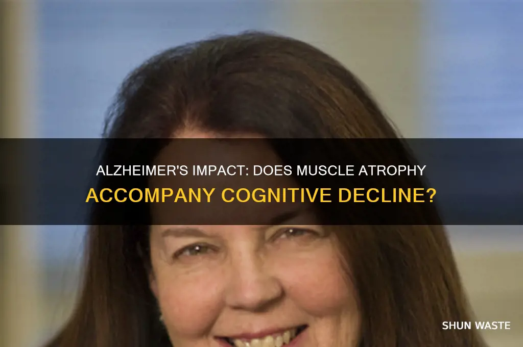 Alzheimer's Impact: Does Muscle Atrophy Accompany Cognitive Decline ...