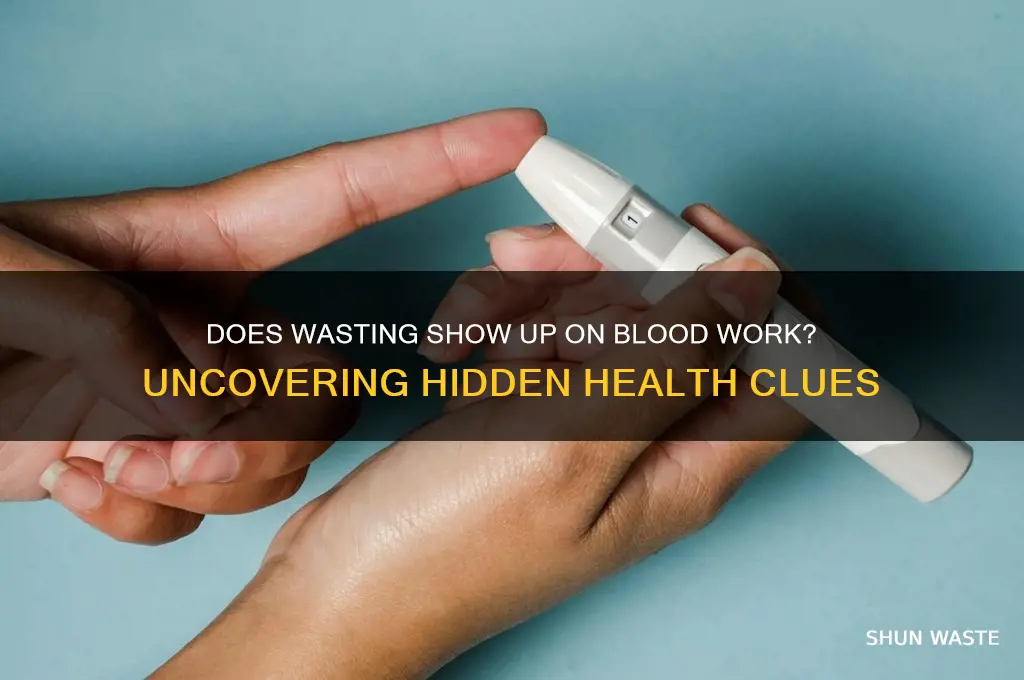 Does Wasting Show Up On Blood Work? Uncovering Hidden Health Clues ...