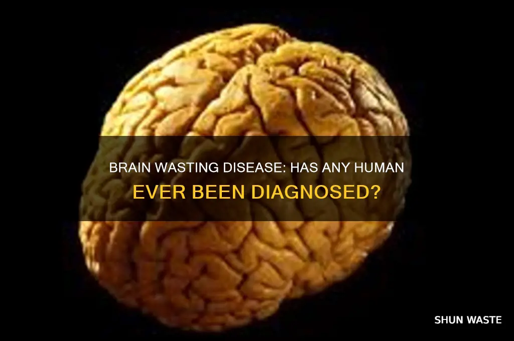 Brain Wasting Disease: Has Any Human Ever Been Diagnosed? | ShunWaste
