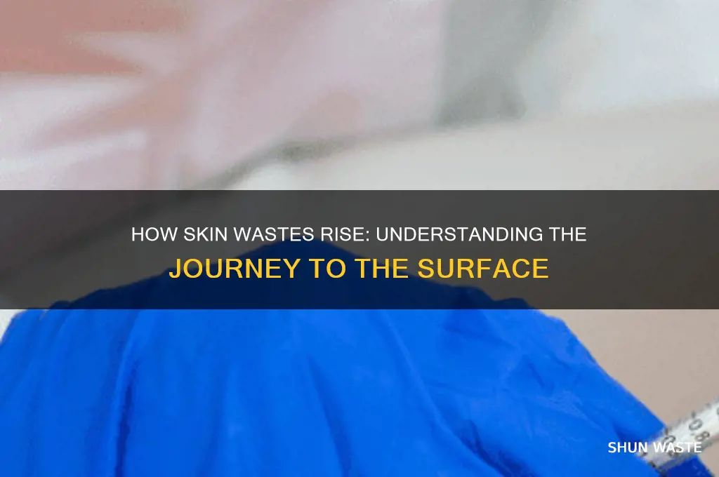 How Skin Wastes Rise: Understanding The Journey To The Surface | ShunWaste