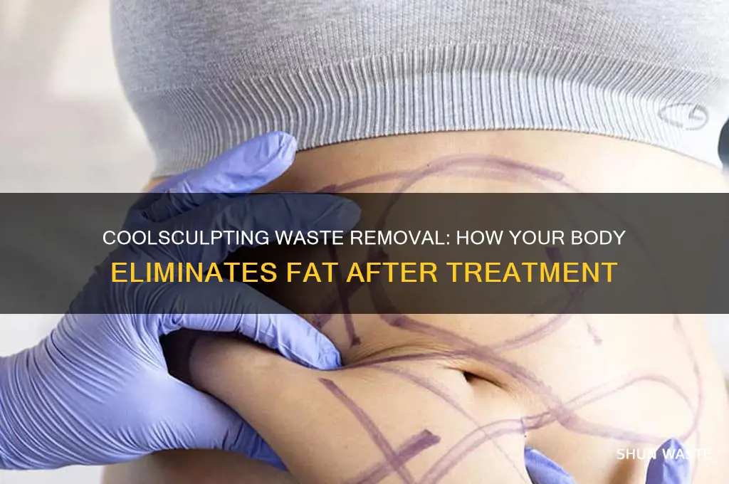 Coolsculpting Waste Removal: How Your Body Eliminates Fat After ...