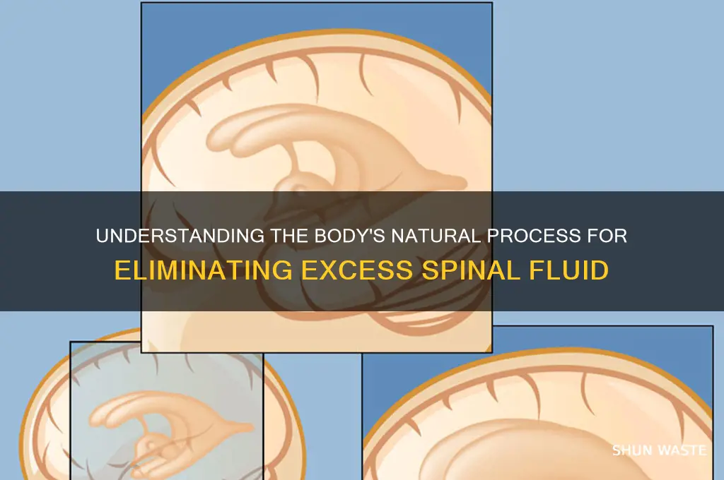 Understanding The Body's Natural Process For Eliminating Excess Spinal ...
