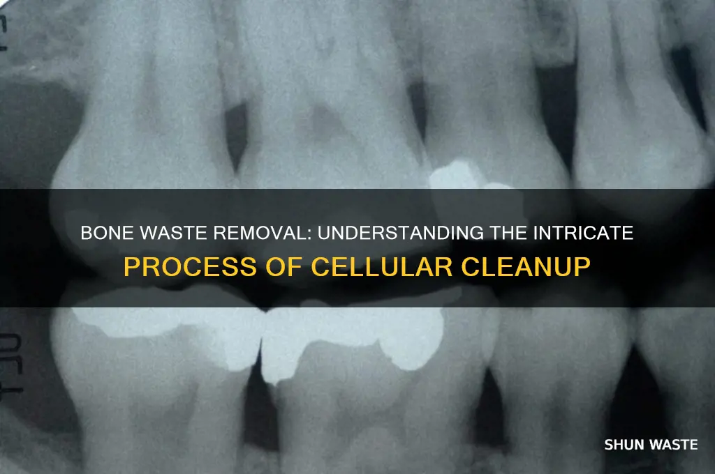 Bone Waste Removal: Understanding The Intricate Process Of Cellular ...
