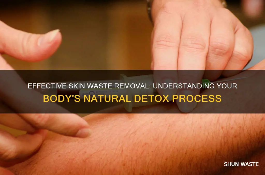 Effective Skin Waste Removal: Understanding Your Body's Natural Detox ...