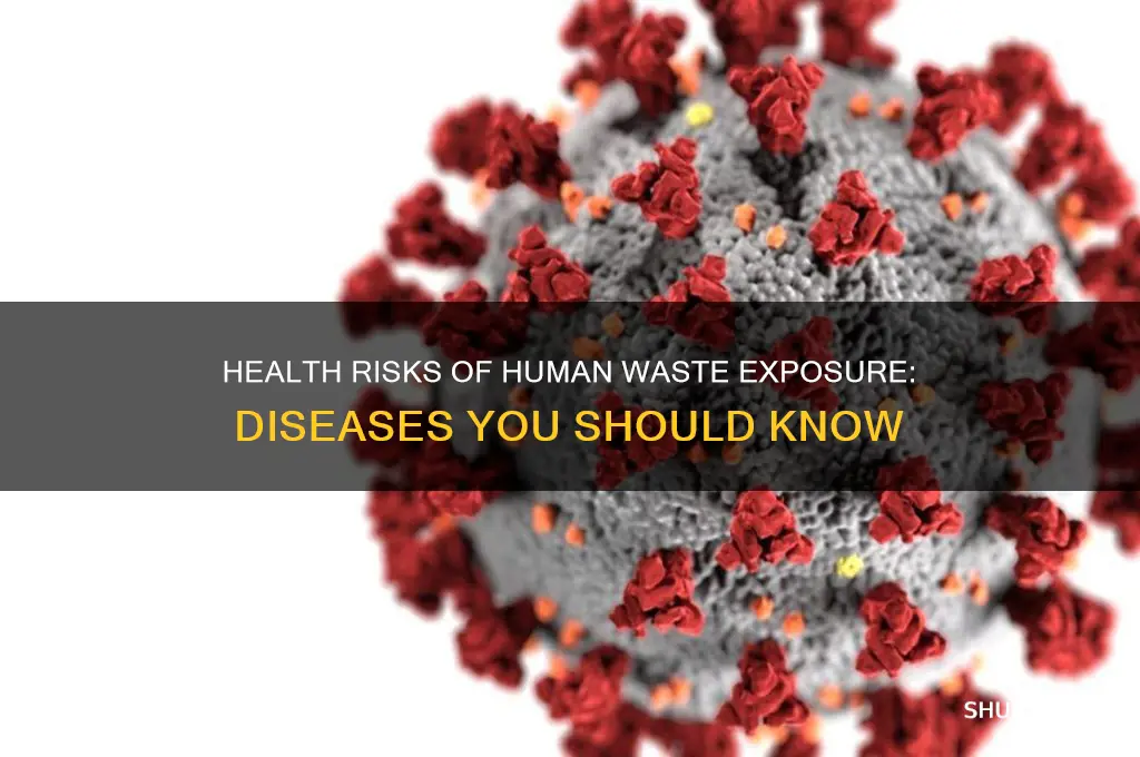 Health Risks Of Human Waste Exposure: Diseases You Should Know | ShunWaste