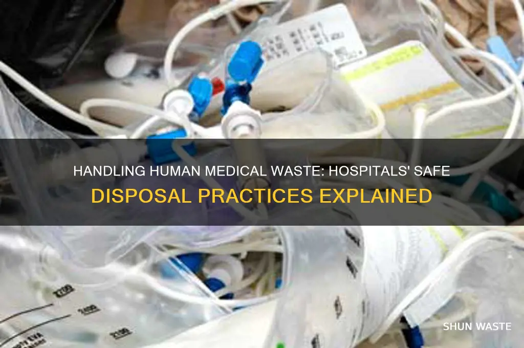 Handling Human Medical Waste: Hospitals' Safe Disposal Practices ...