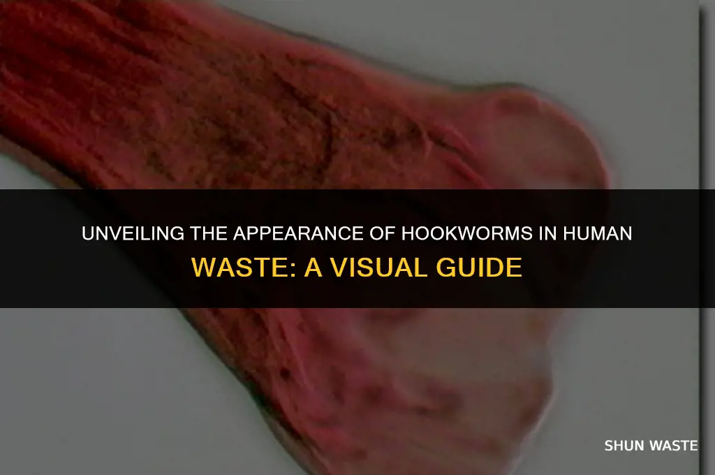 Unveiling The Appearance Of Hookworms In Human Waste: A Visual Guide ...
