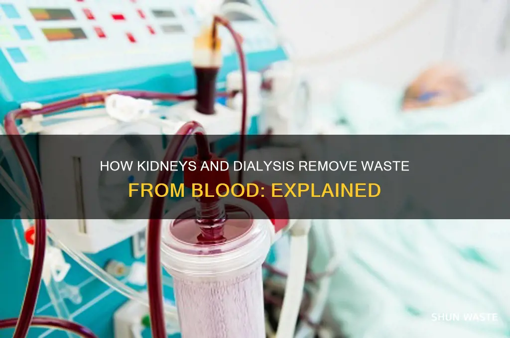 How Kidneys And Dialysis Remove Waste From Blood: Explained | ShunWaste