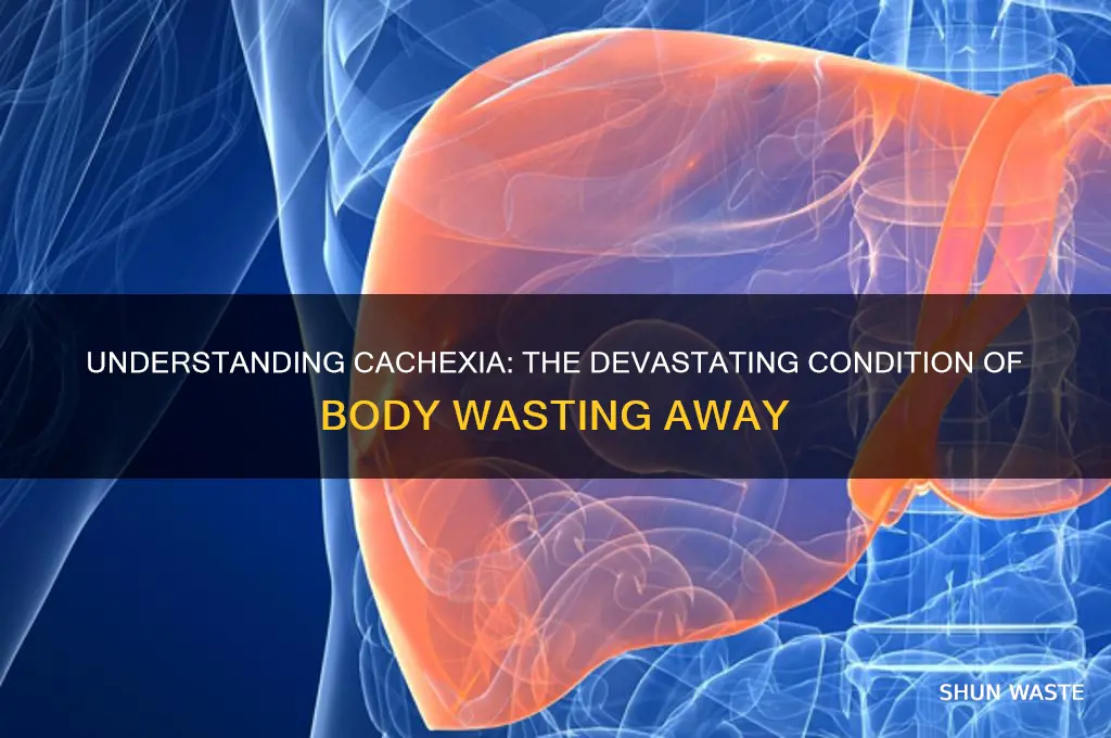 Understanding Cachexia: The Devastating Condition Of Body Wasting Away ...