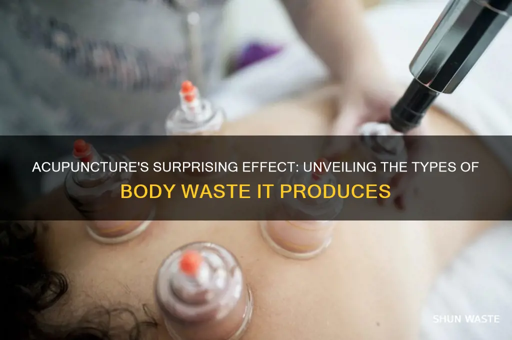 Acupuncture's Surprising Effect: Unveiling The Types Of Body Waste It ...